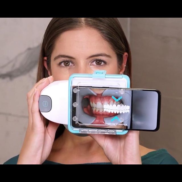 Replacement Scan Box with Retractor – Queensway Orthodontics